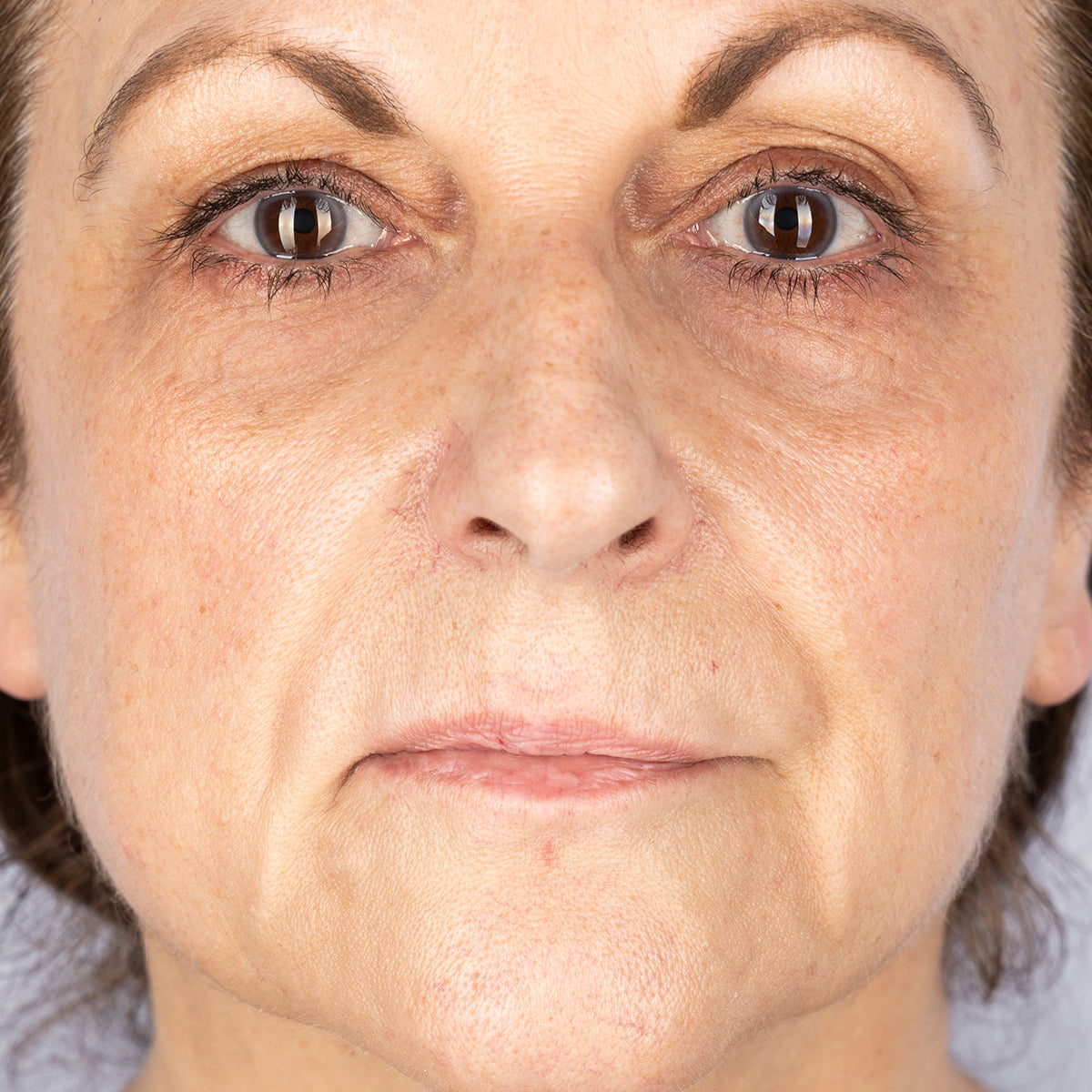 CurrentBody Skin RF Device | CurrentBody | CurrentBody Canada