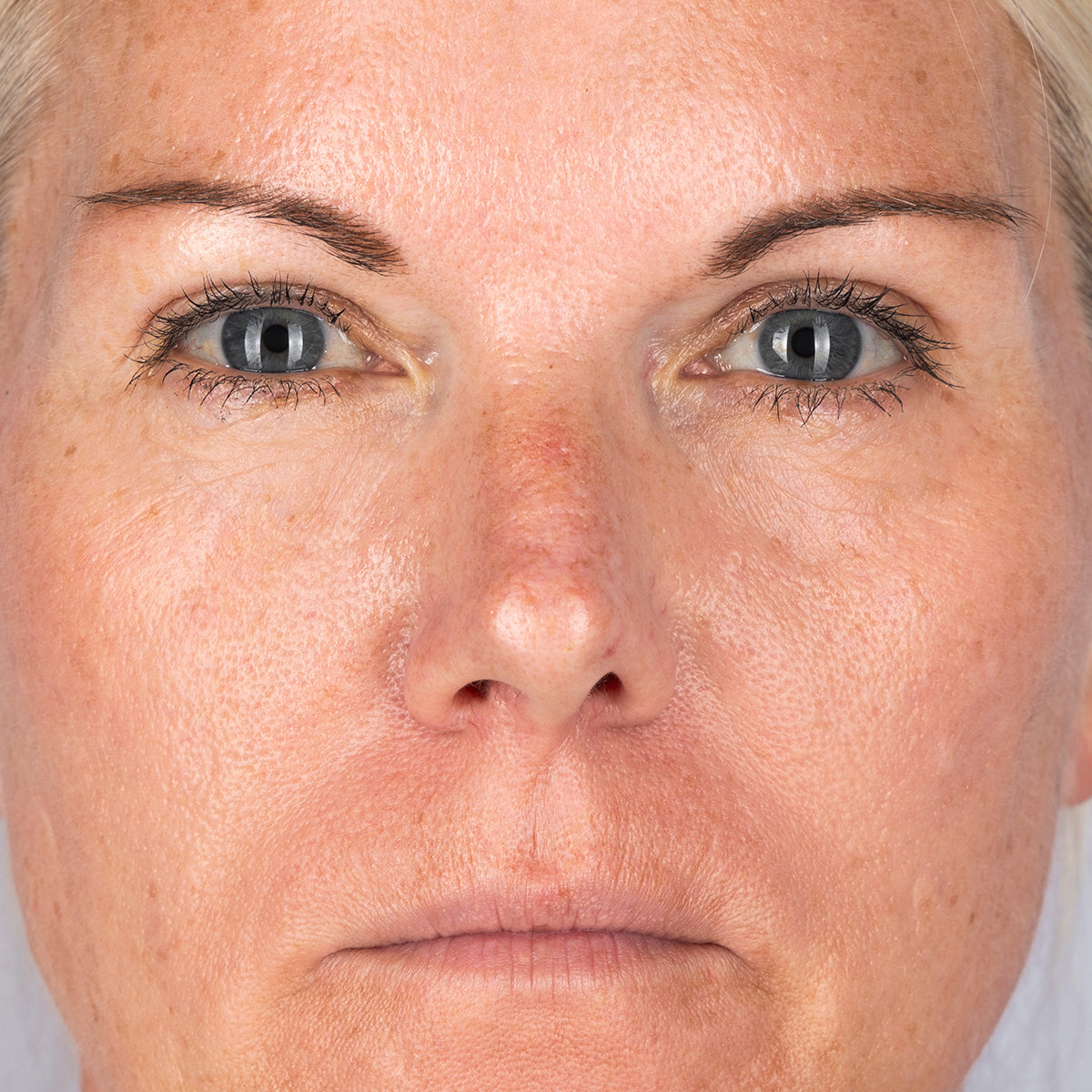 CurrentBody Skin RF Device | CurrentBody | CurrentBody Canada