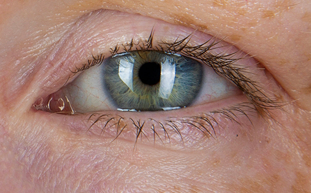 CurrentBody Skin Radio Frequency Device | CurrentBody