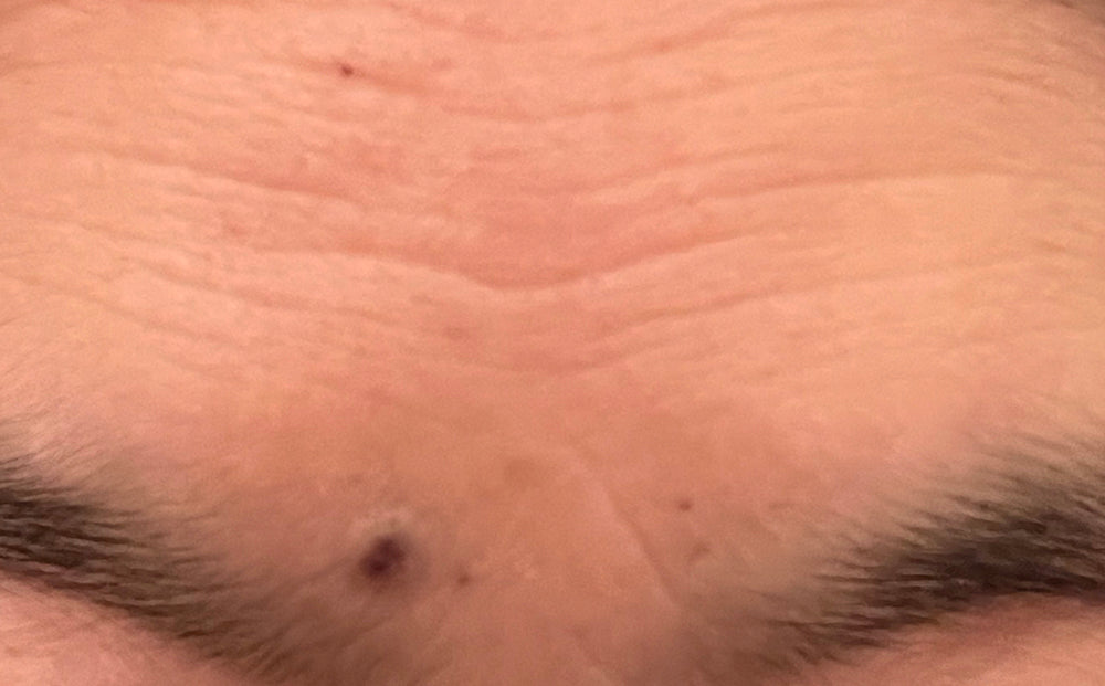 CurrentBody Skin Radio Frequency Device | CurrentBody