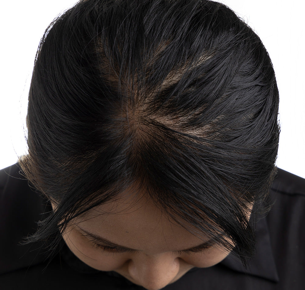 LED Hair Growth Helmet | Red Light Therapy for Hair Loss | CurrentBody HK