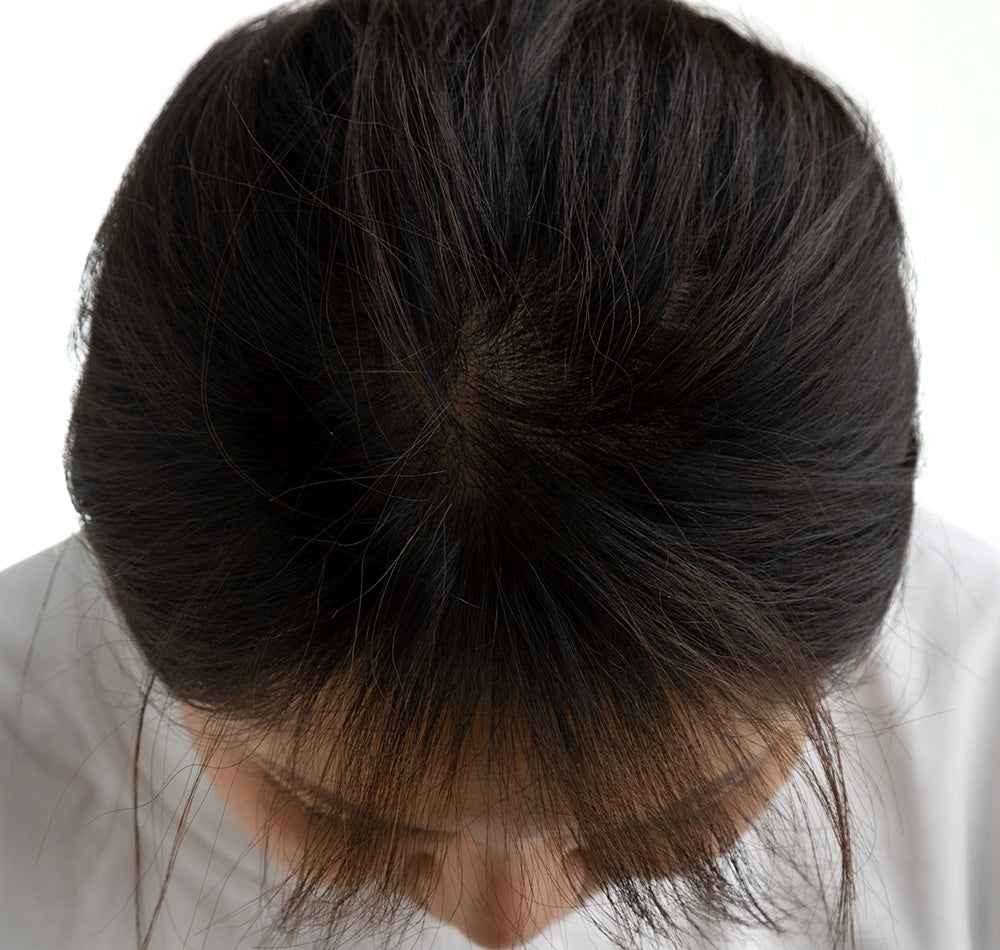 Ricrescita Capelli | Casco LED per la Ricrescita dei Capelli ...