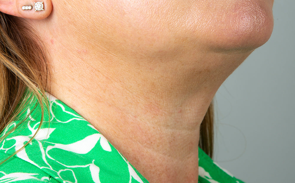 CurrentBody Skin Radio Frequency Device | CurrentBody