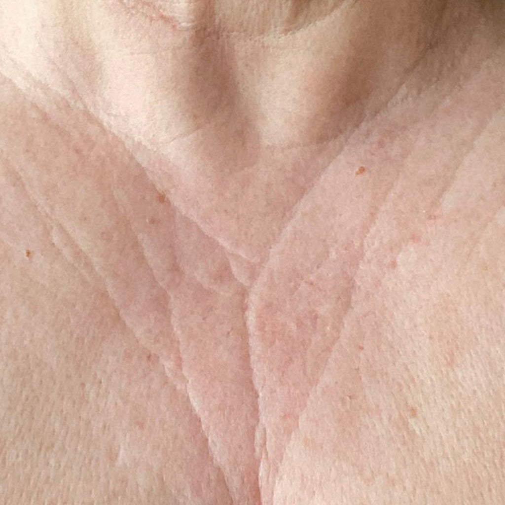 LED Neck and Dec Perfector | Chest Wrinkle Treatment | CurrentBody Skin