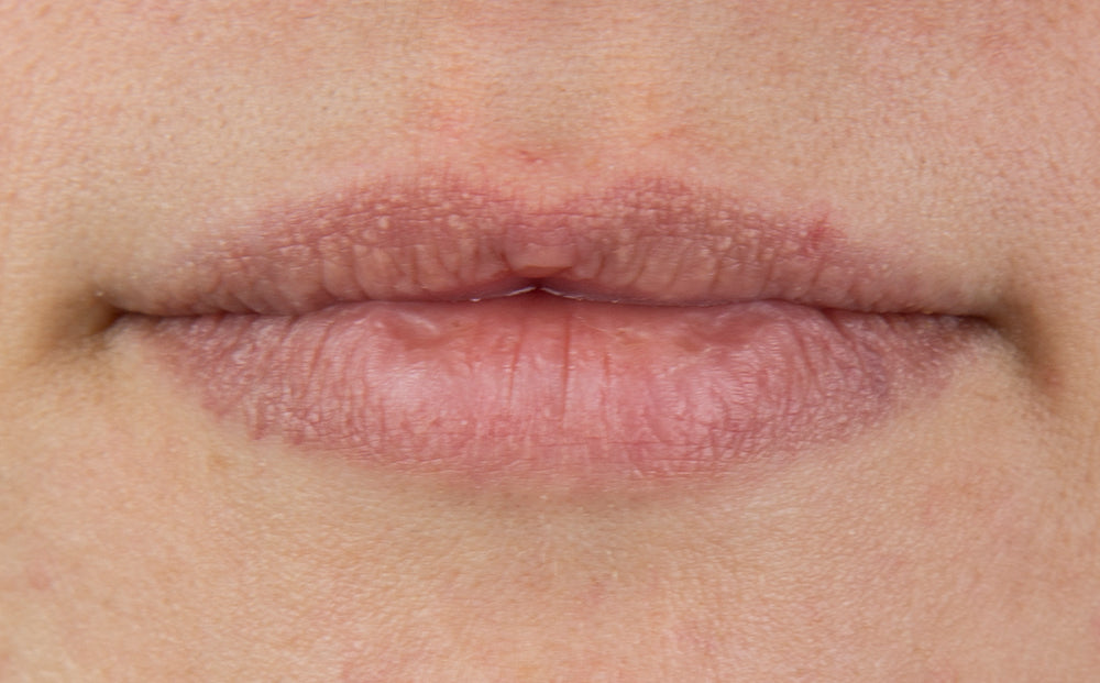 LED Lip Perfector | Lip Wrinkle & Volume Device | CurrentBody Skin